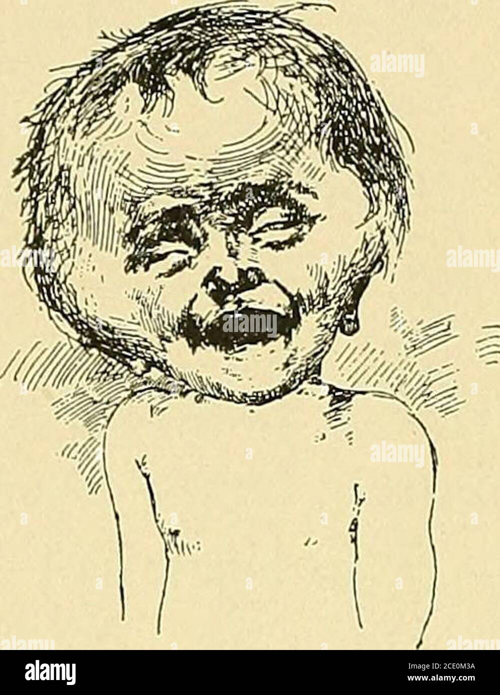 Lateral angle measurement hi-res stock photography and images - Alamy