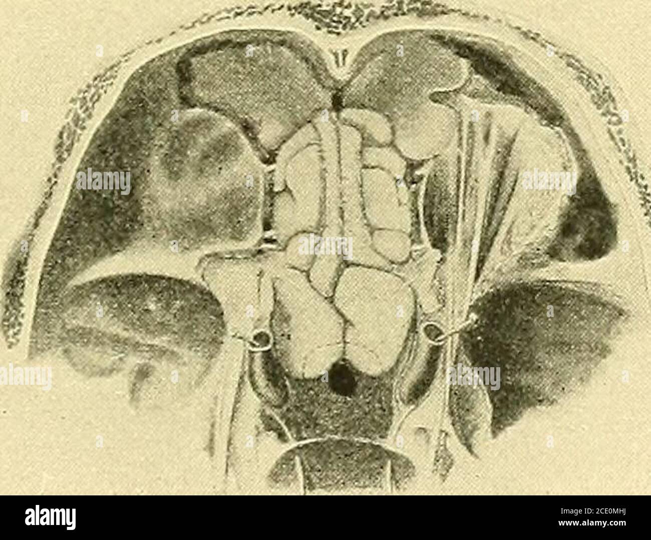 . Some points in the surgery of the brain and its membranes . Fig. 30 ...