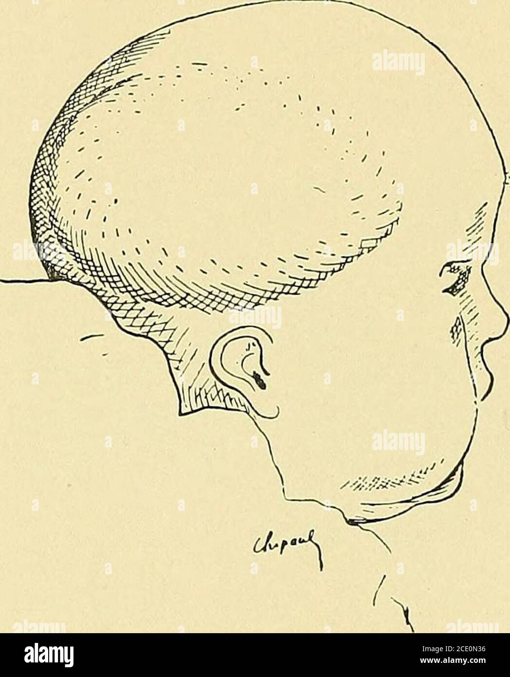 . Some points in the surgery of the brain and its membranes . e of ...