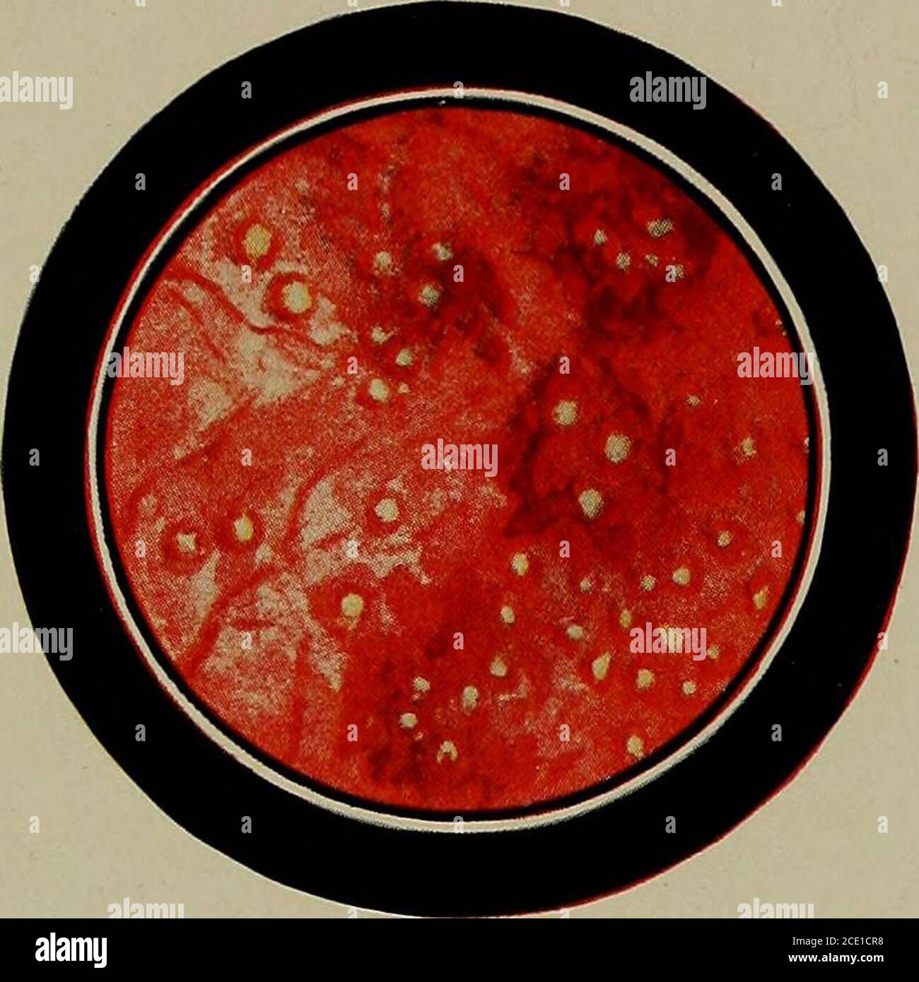 . Syphilis : a treatise on etiology, pathology, diagnosis, prognosis ...