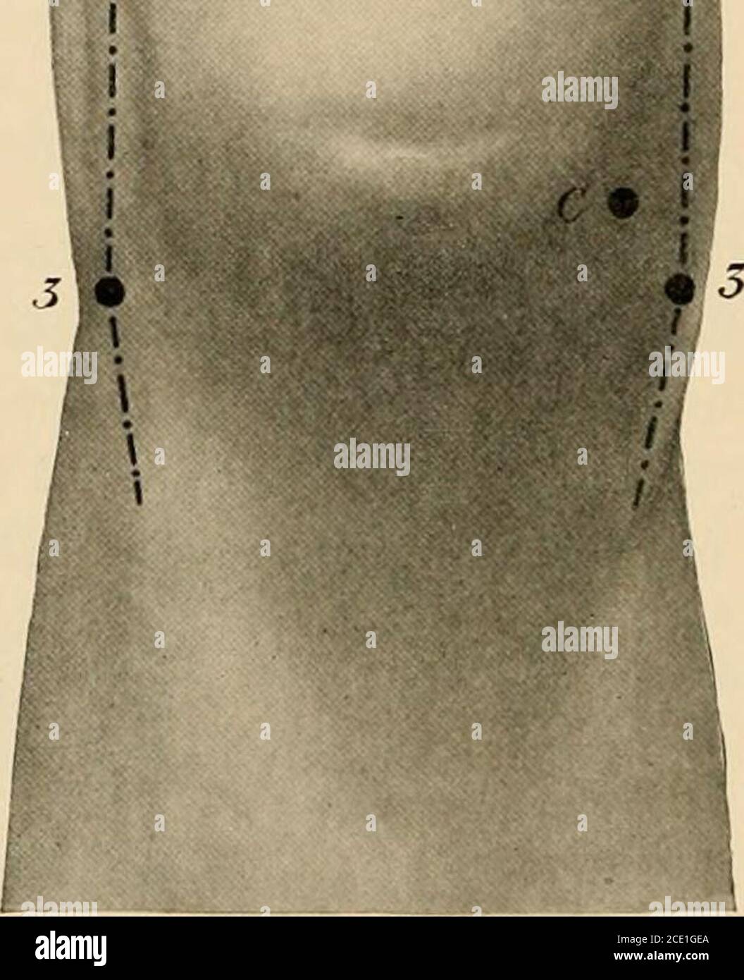 Joint injections hi-res stock photography and images - Alamy