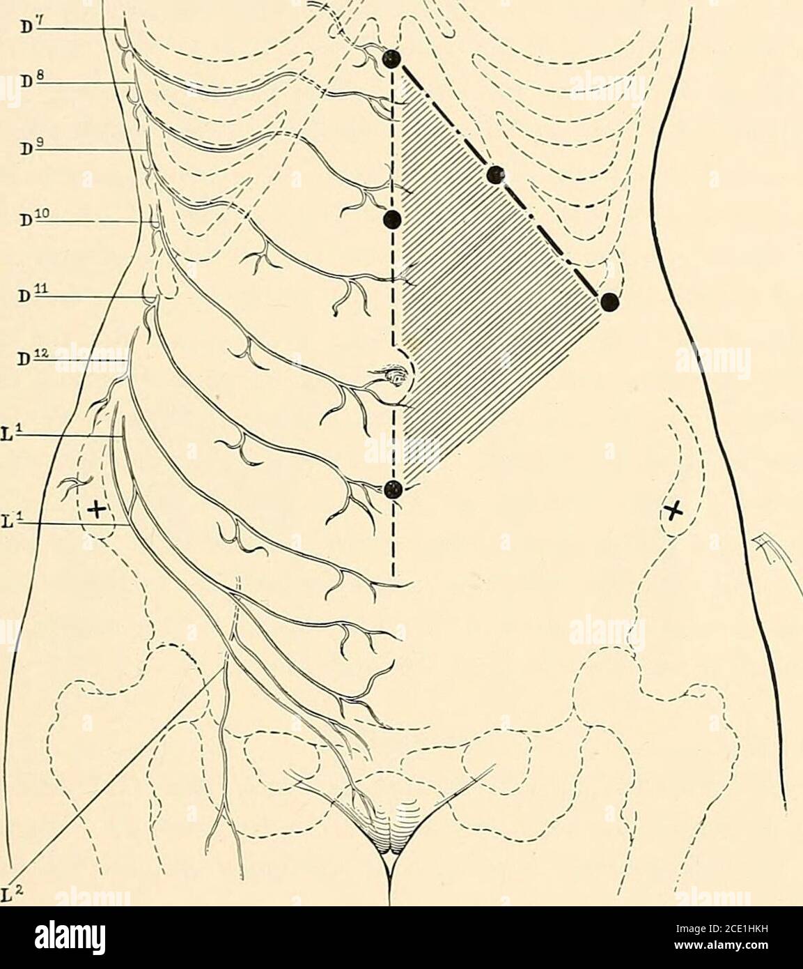 Gastrostomy procedure hi-res stock photography and images - Alamy