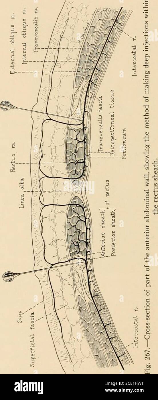 Intercostal block hi-res stock photography and images - Alamy