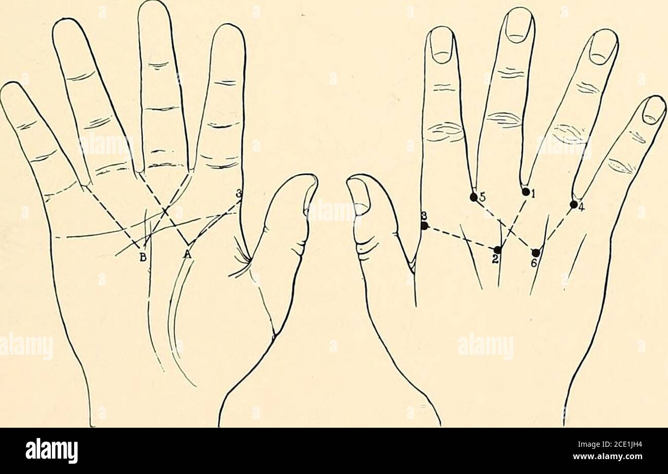 . Regional anesthesia : its technic and clinical application . Fig. 249 ...
