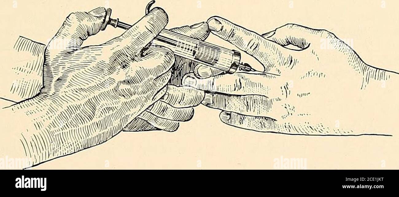 . Regional anesthesia : its technic and clinical application . Fig. 246 ...