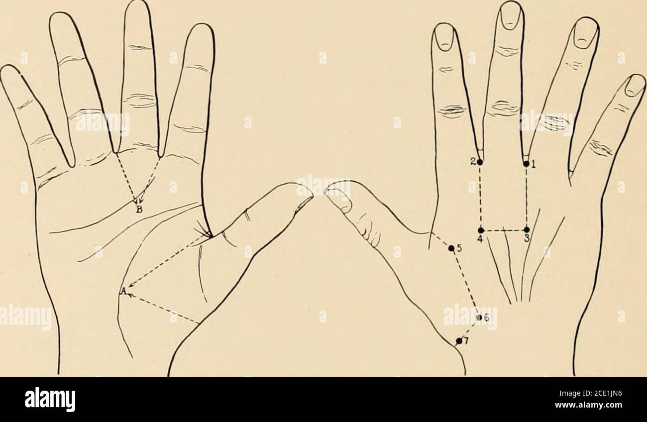 . Regional anesthesia : its technic and clinical application . Fig. 247 ...