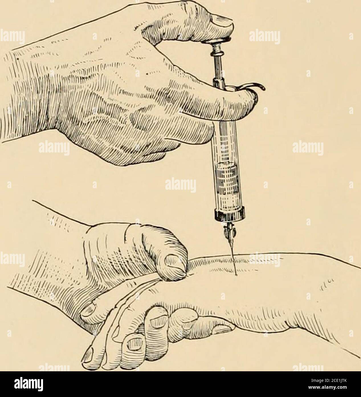 . Regional anesthesia : its technic and clinical application . Fig. 244 ...