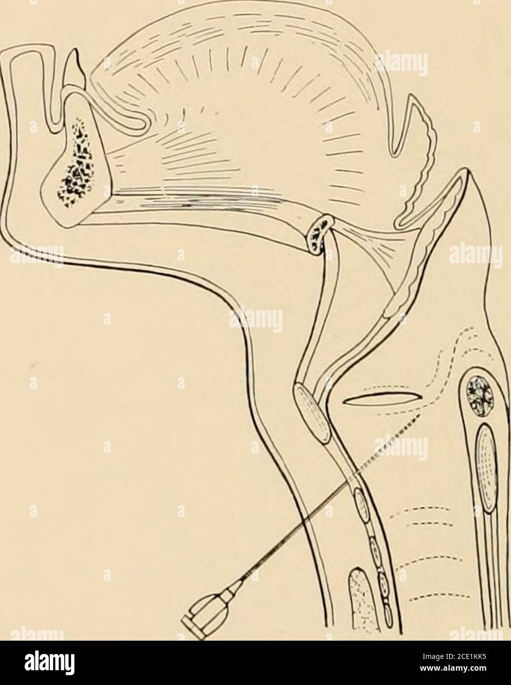 . Regional anesthesia : its technic and clinical application . o wheals ...