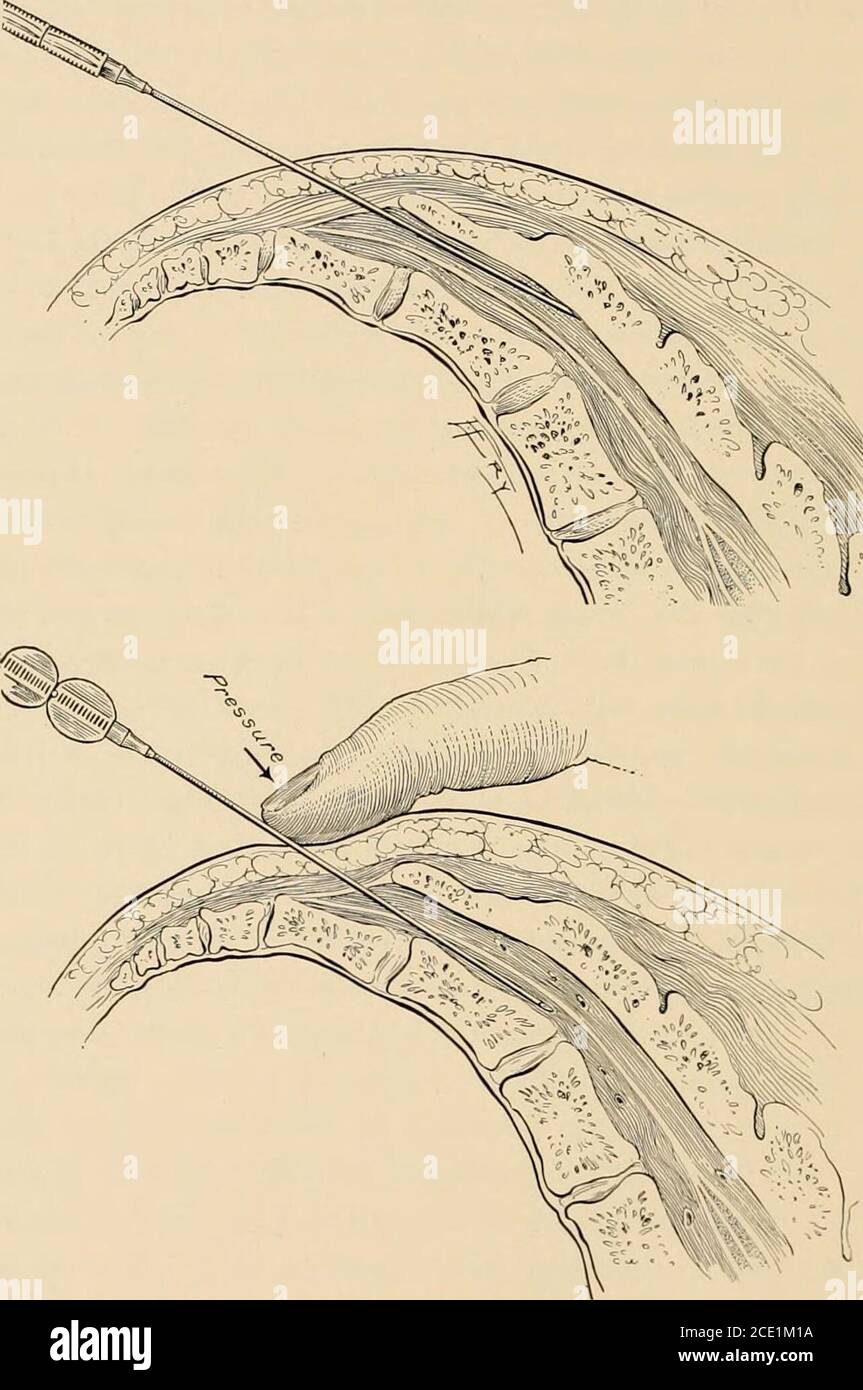 . Regional anesthesia : its technic and clinical application ...
