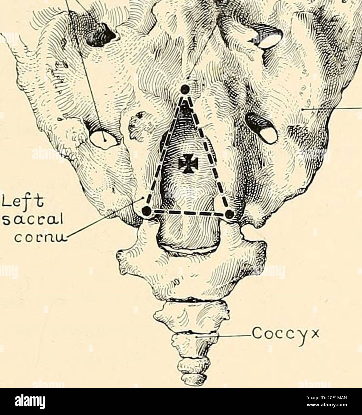 . Regional anesthesia : its technic and clinical application . 1 Fig ...