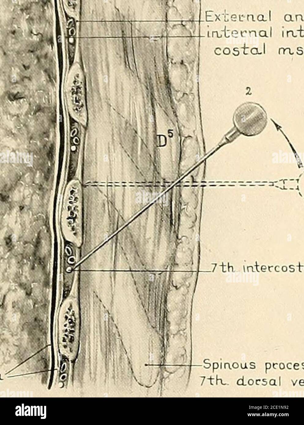 . Regional anesthesia : its technic and clinical application ...
