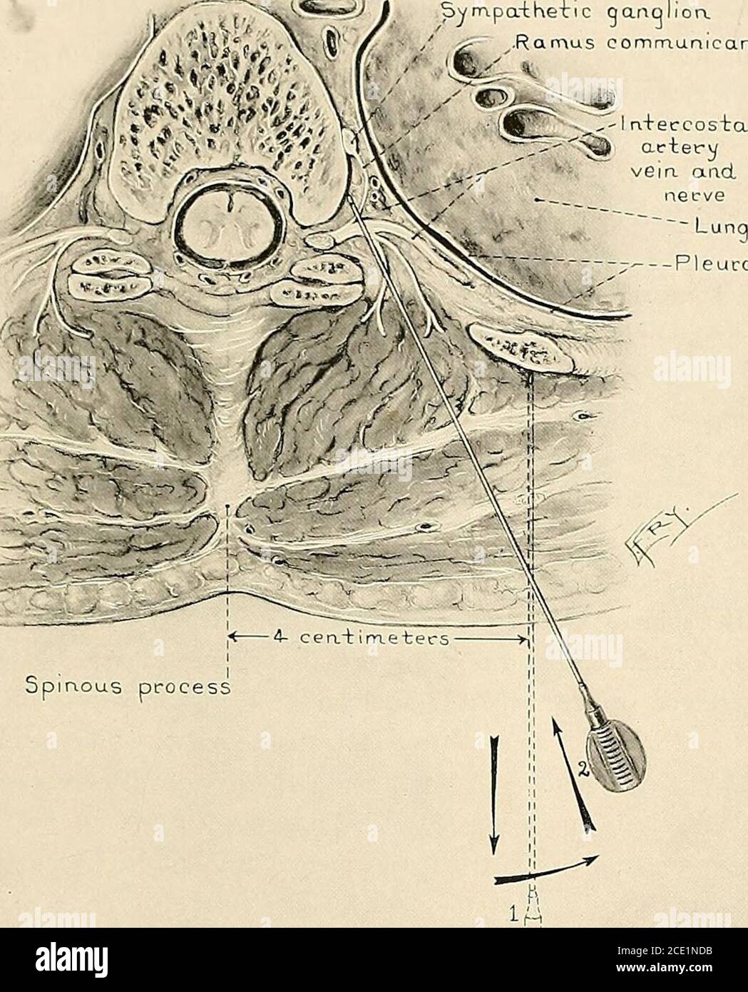 Impinges hi-res stock photography and images - Alamy