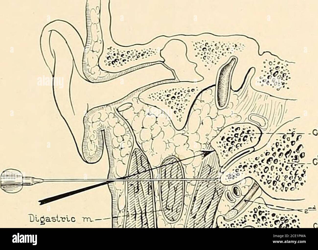 . Regional anesthesia : its technic and clinical application ...