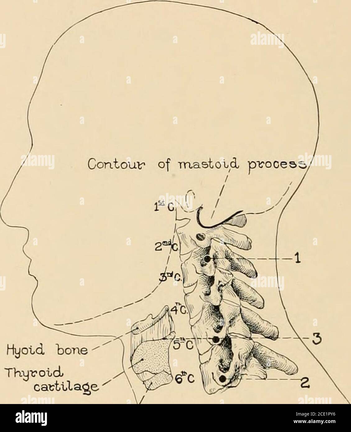 . Regional anesthesia : its technic and clinical application . th ...