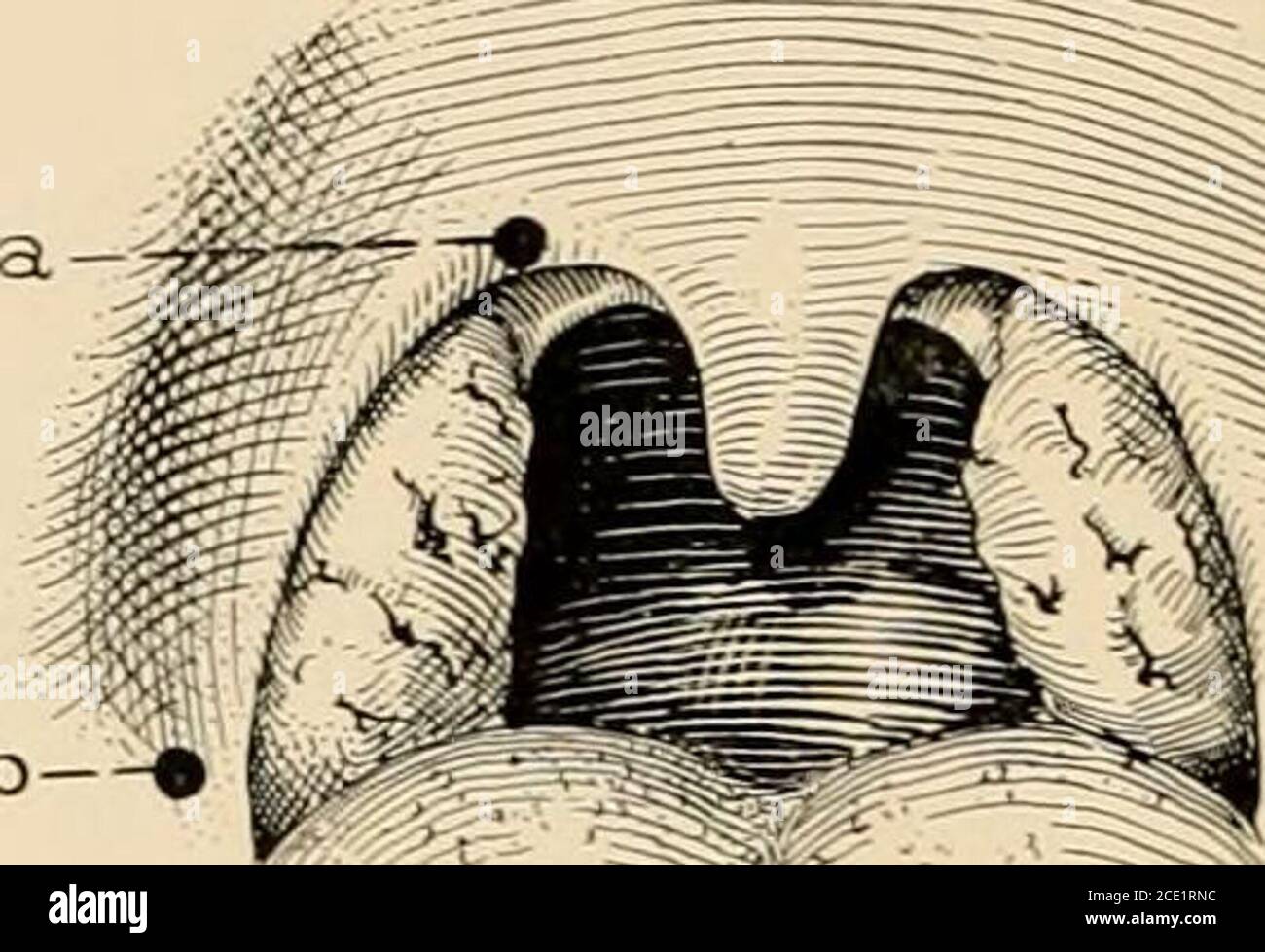 . Regional anesthesia : its technic and clinical application . al ...