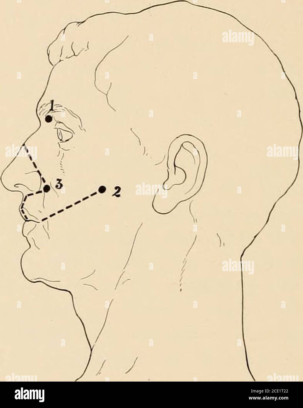 . Regional anesthesia : its technic and clinical application . ons ...