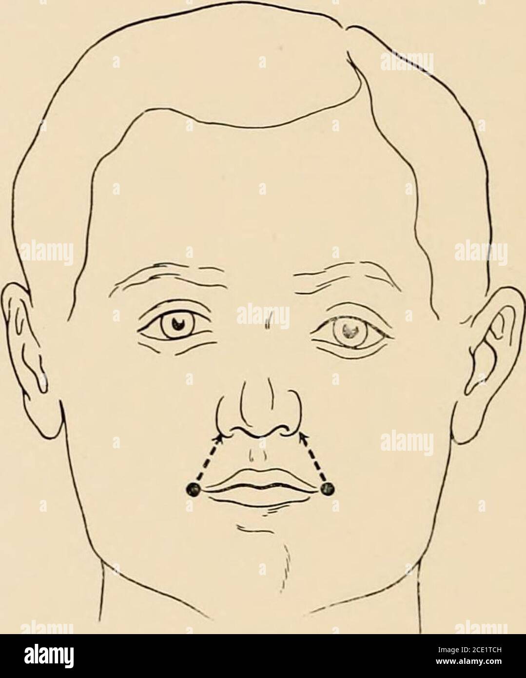 . Regional anesthesia : its technic and clinical application . lock ...
