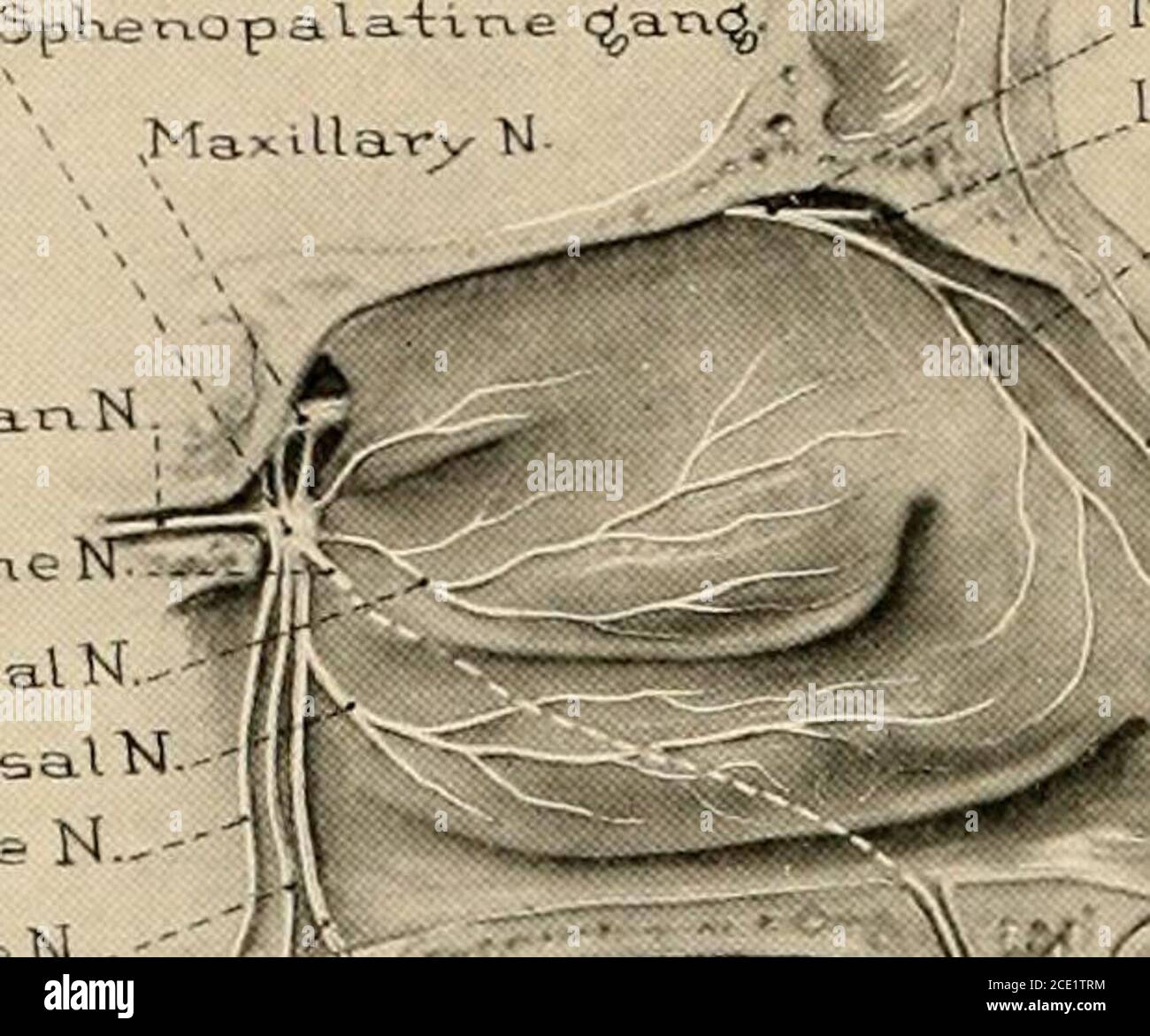 Infratrochlear Nerve