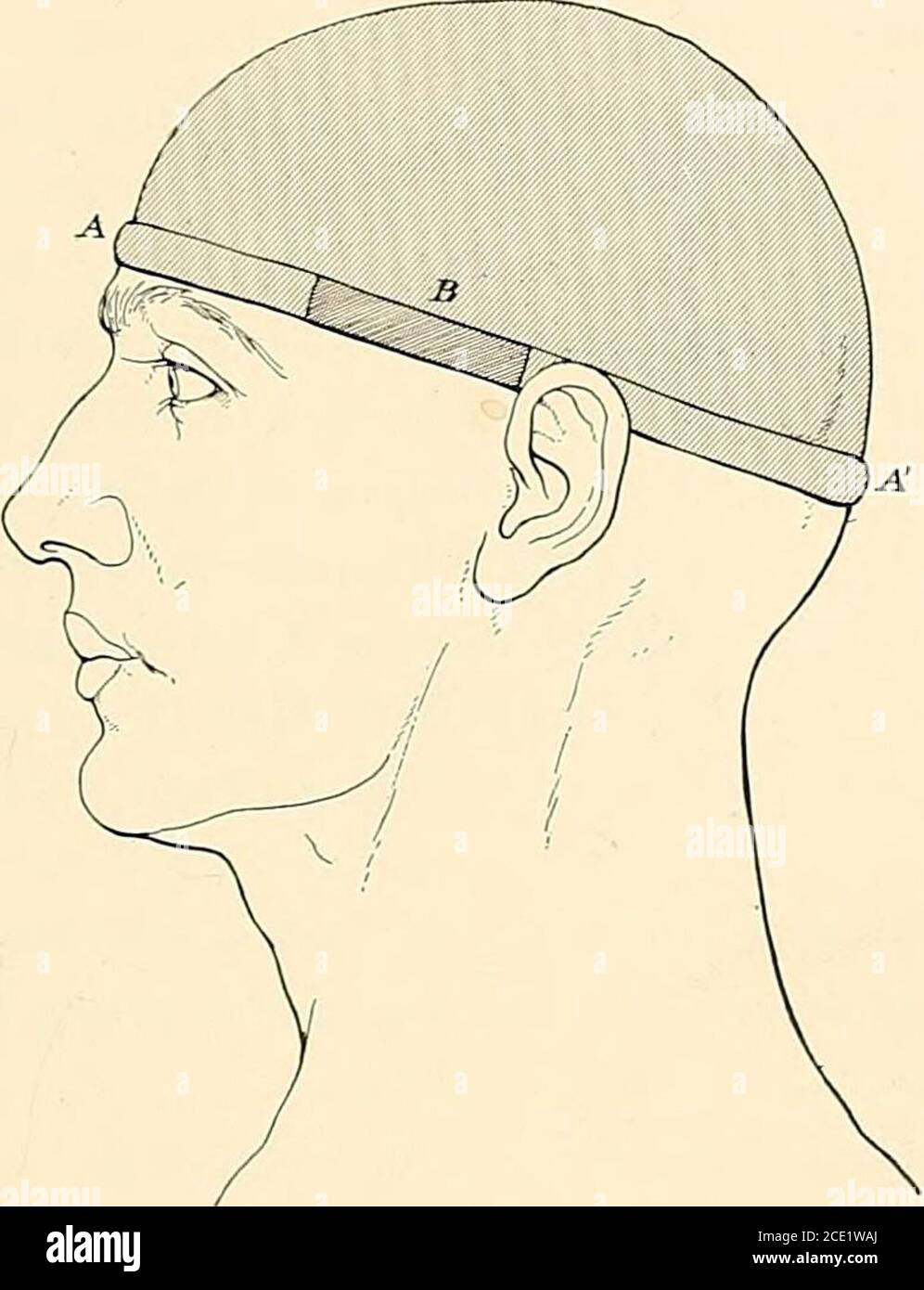 Occipital nerve injection hi-res stock photography and images - Alamy