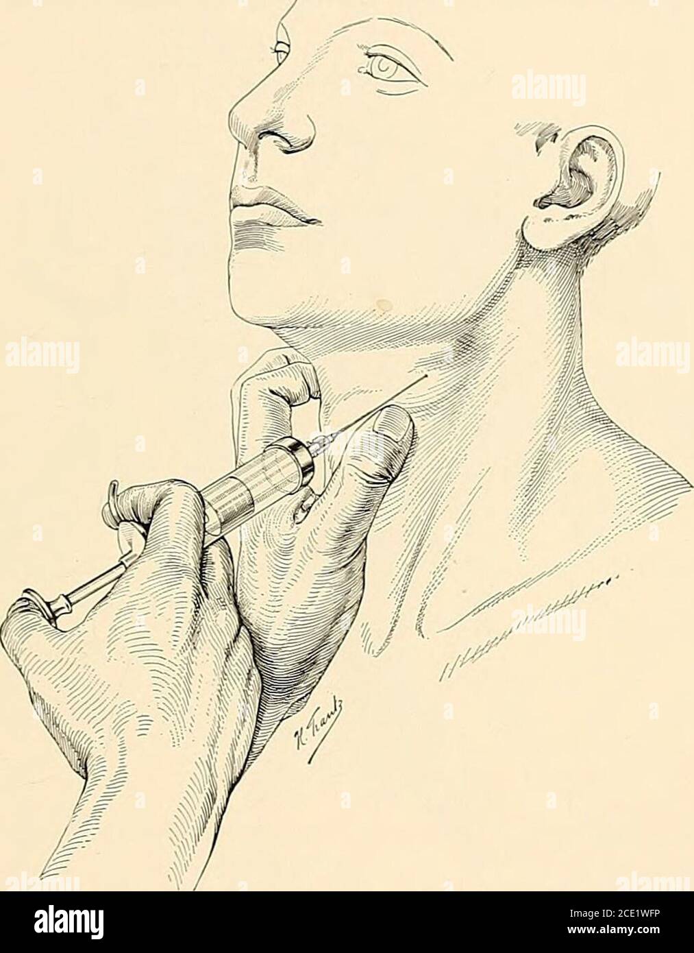 . Regional anesthesia : its technic and clinical application . epharynx ...