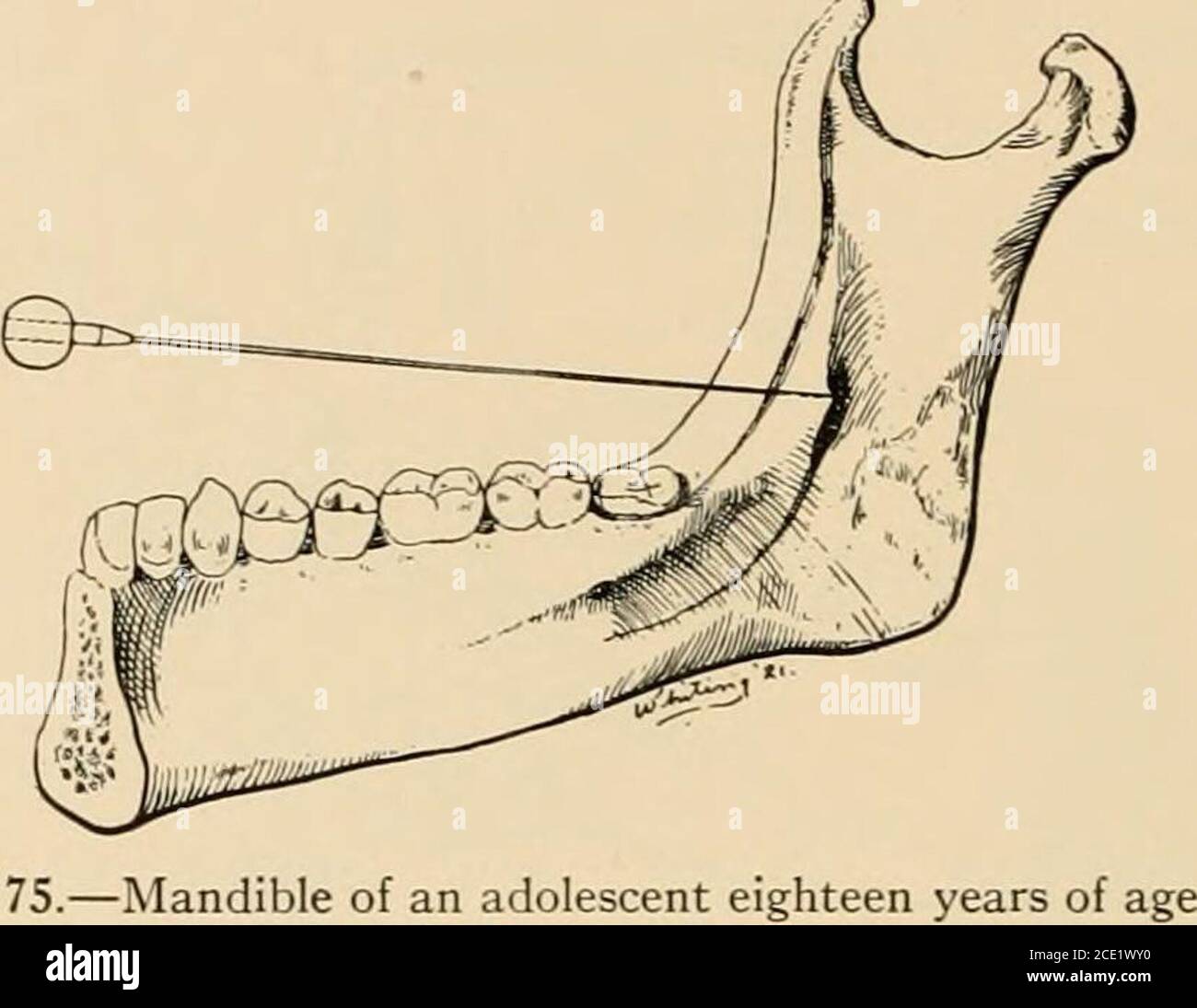 Mandib hi-res stock photography and images - Alamy