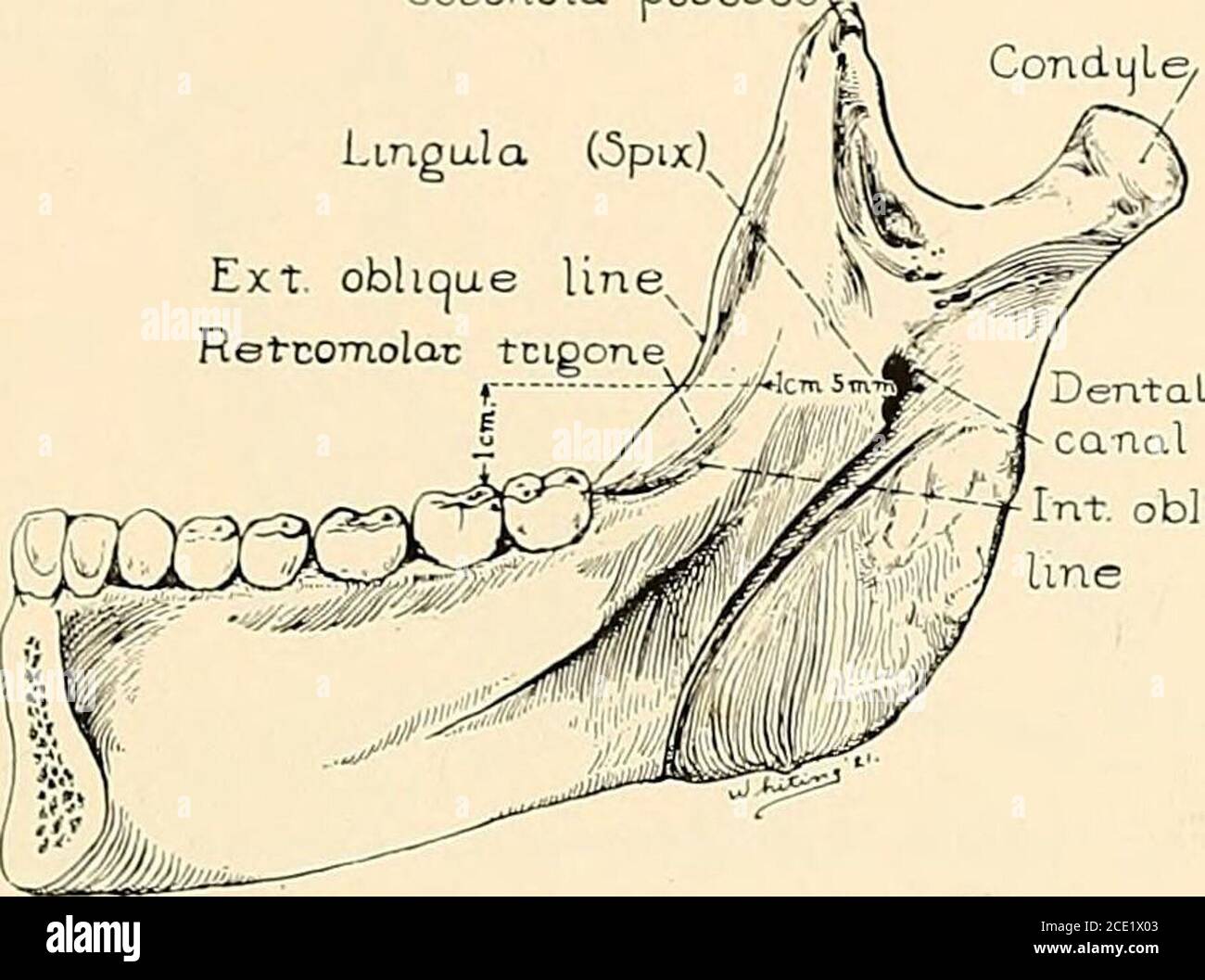 Internal Oblique Ridge
