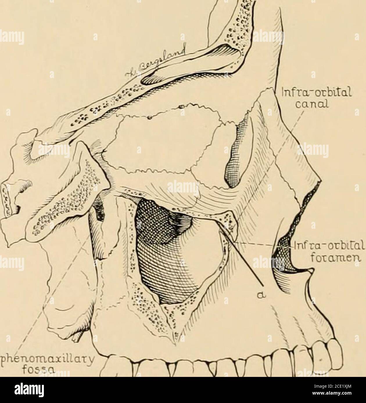 . Regional anesthesia : its technic and clinical application . Fig. 59 ...