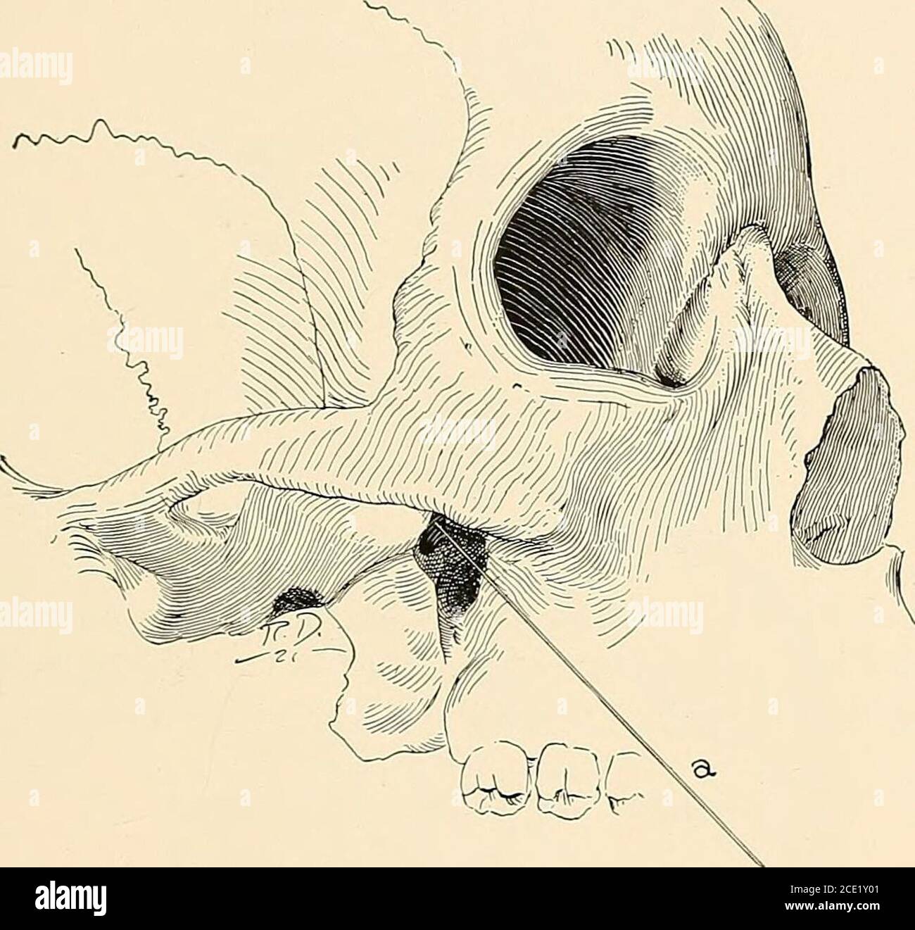. Regional anesthesia : its technic and clinical application . ig. 48 ...