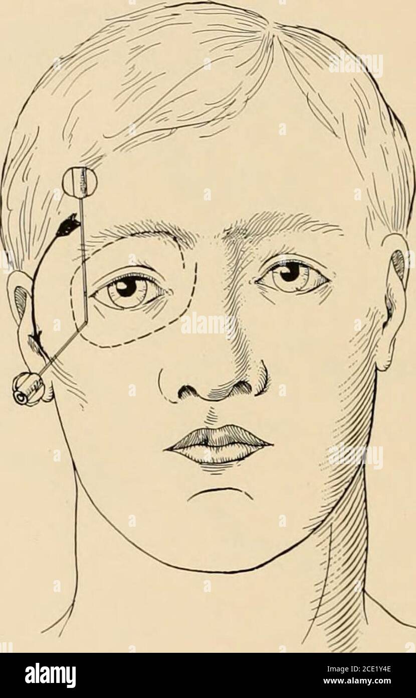. Regional anesthesia : its technic and clinical application . clined ...