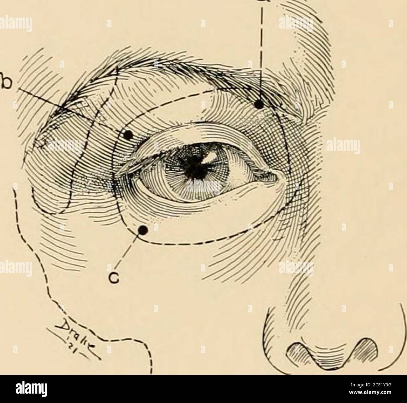 Lateral canthus hi-res stock photography and images - Alamy