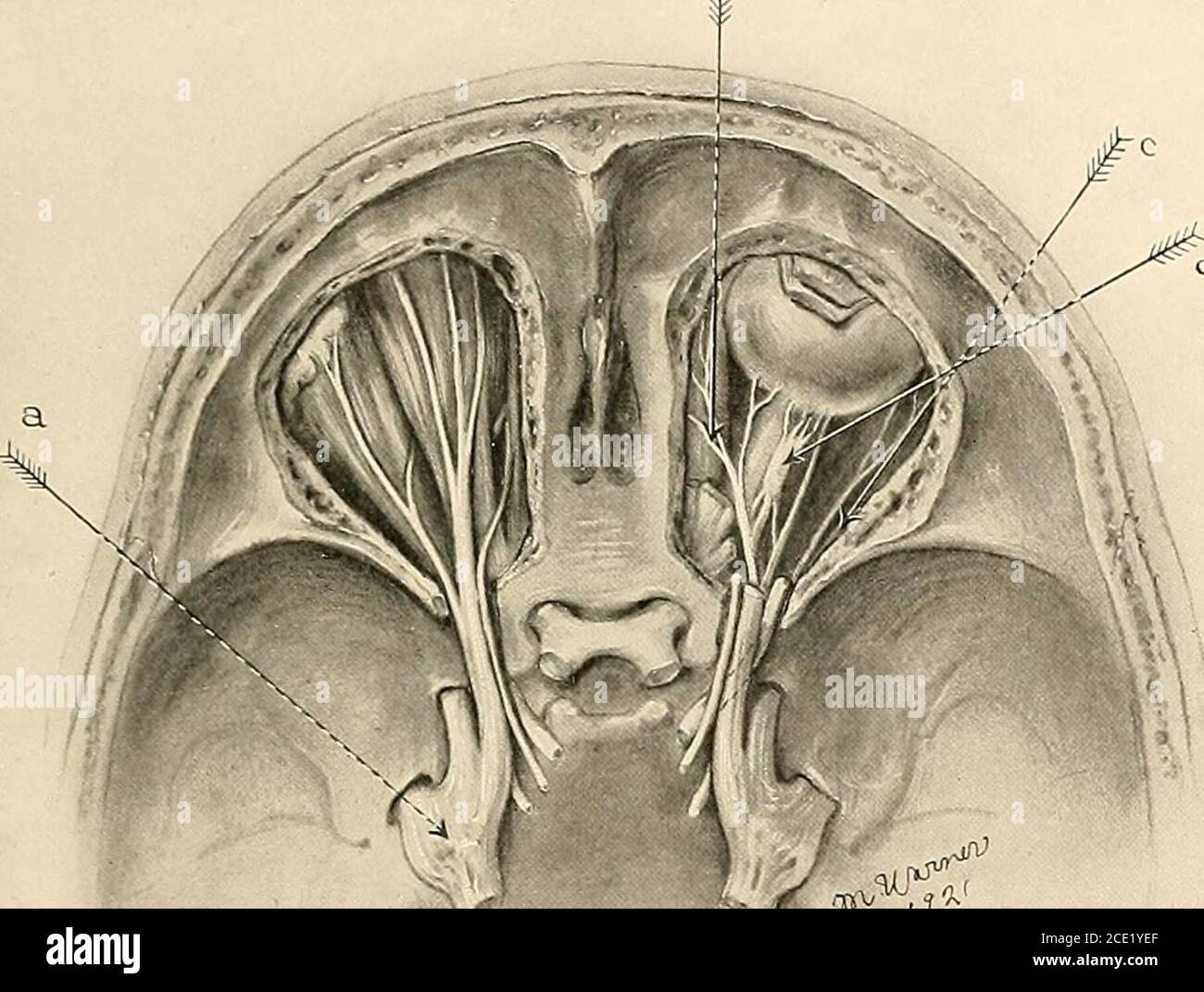 . Regional anesthesia : its technic and clinical application . Fig. 36 ...