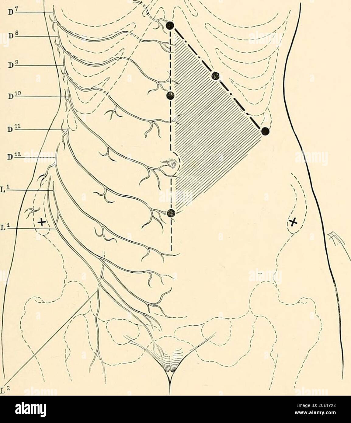 . Regional anesthesia : its technic and clinical application . Fig. 25 ...