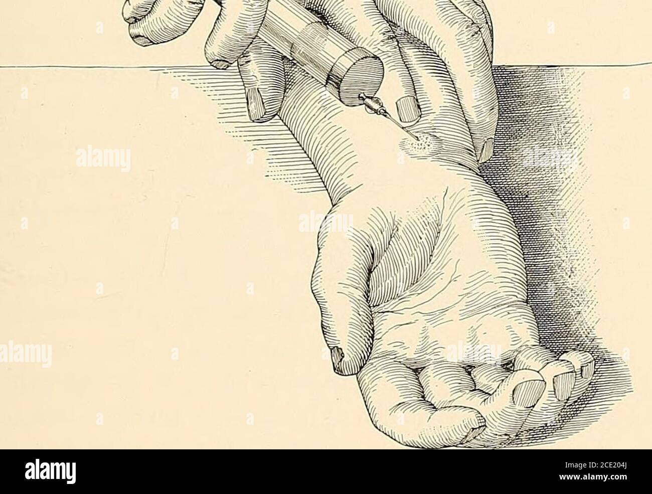 Punctured Skin High Resolution Stock Photography and Images - Alamy
