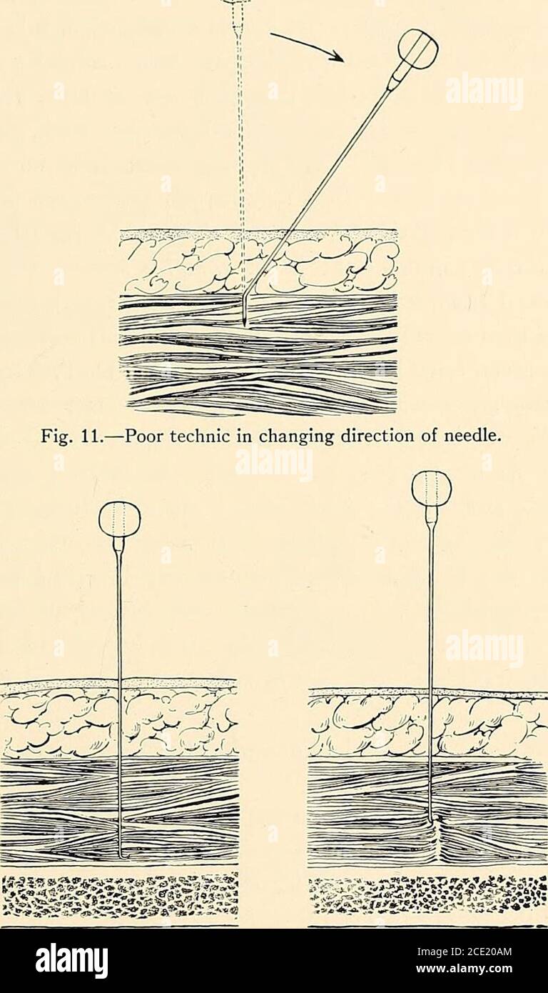 Sudden change of direction hi-res stock photography and images - Alamy