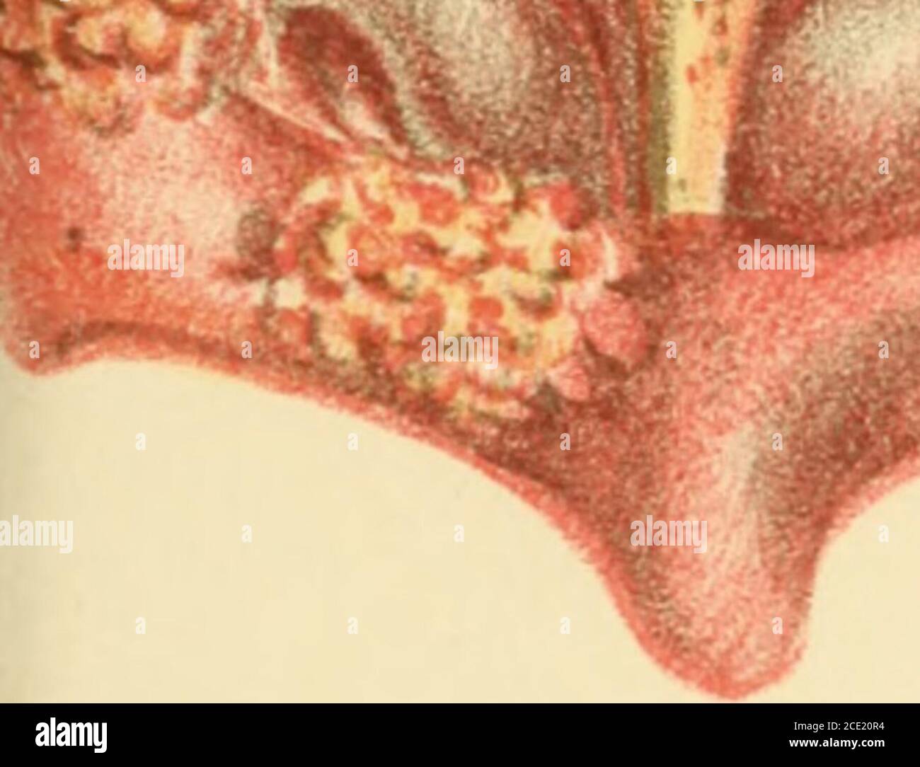 . Rhinoscopy and laryngoscopy, their value in practical medicine Stock ...