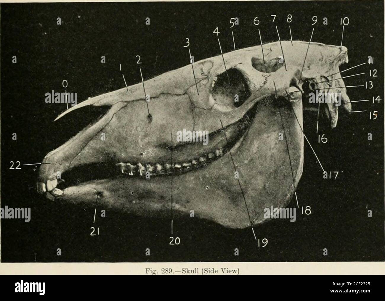 Upper maxillary bones hi-res stock photography and images - Alamy