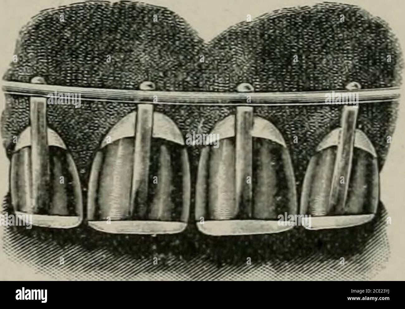 Dental crown development hi-res stock photography and images - Alamy