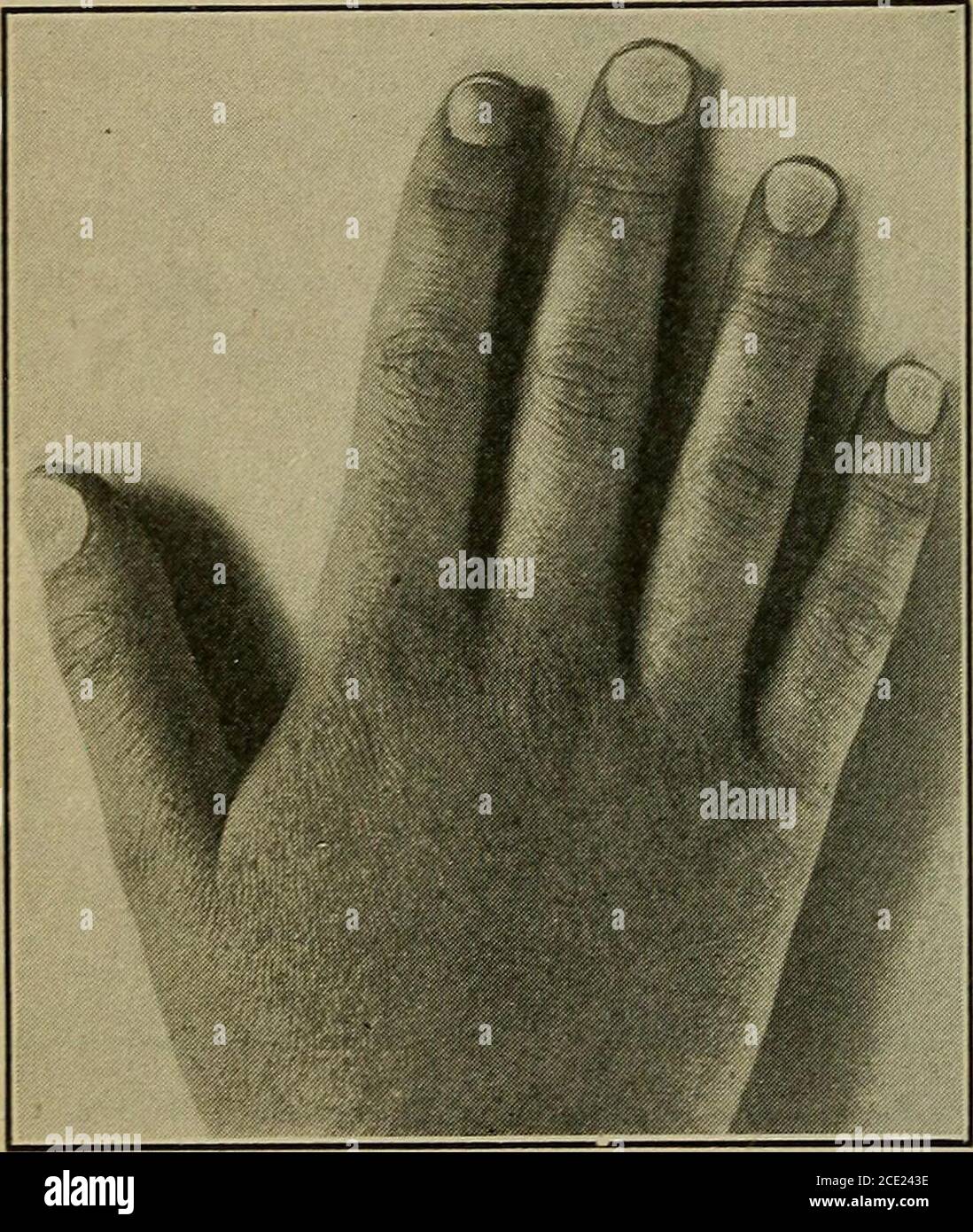 Epithelial cells from the human hi-res stock photography and images - Alamy