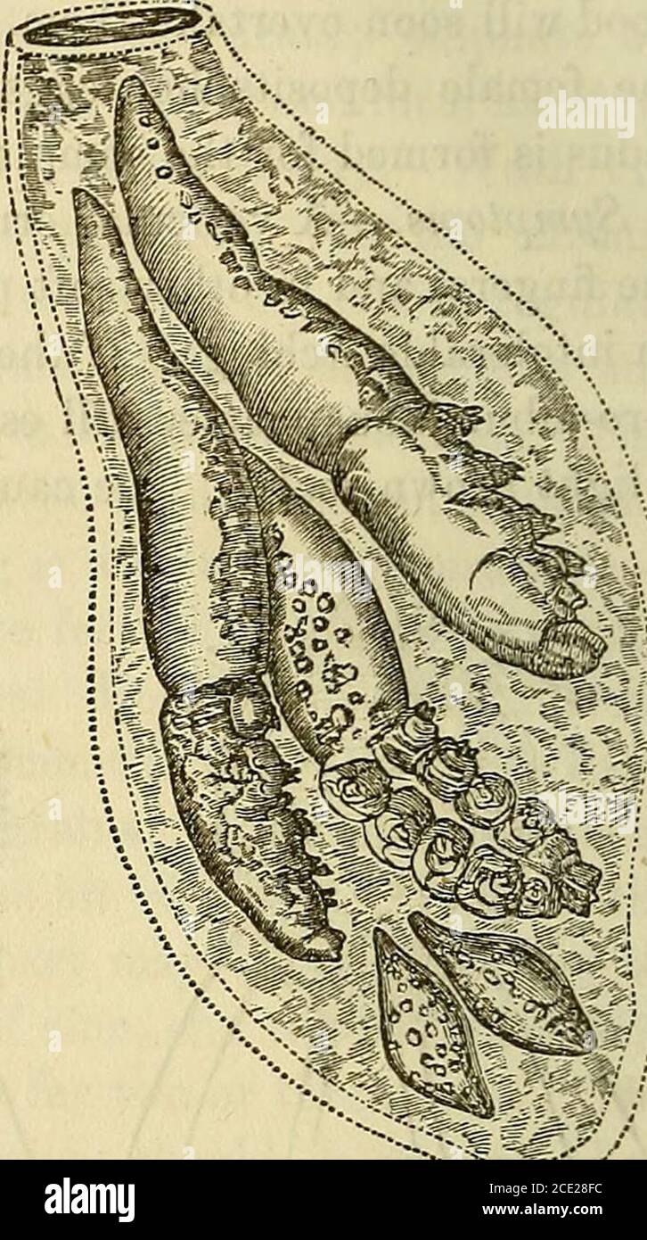 Folliculorum hi-res stock photography and images - Alamy