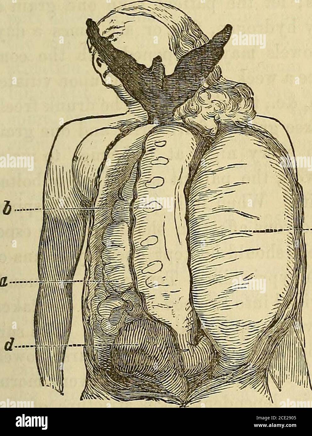. A treatise on the principles and practice of medicine and pathology ...