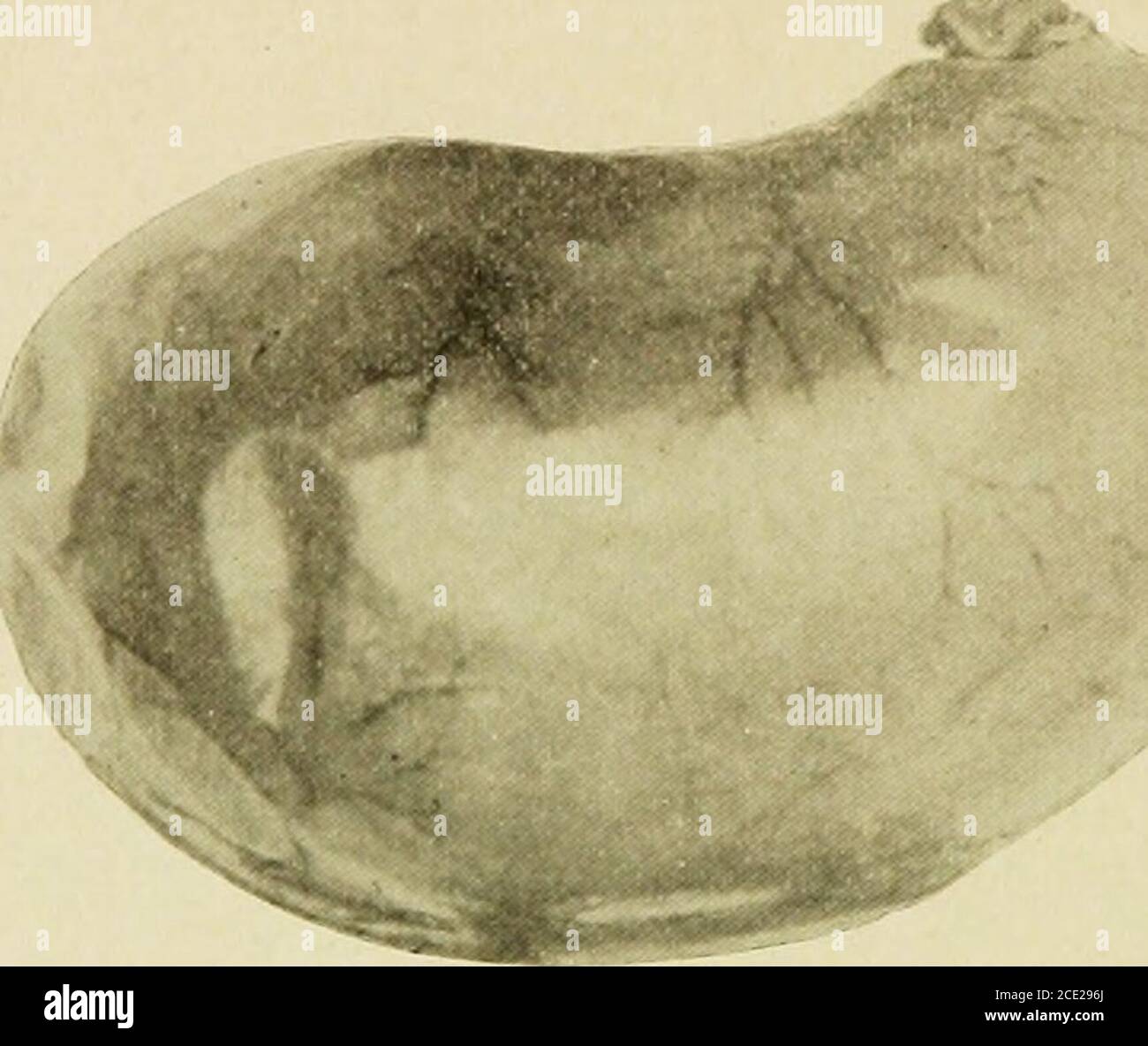 . Lessons on the anatomy, physiology and hygiene of infancy and ...