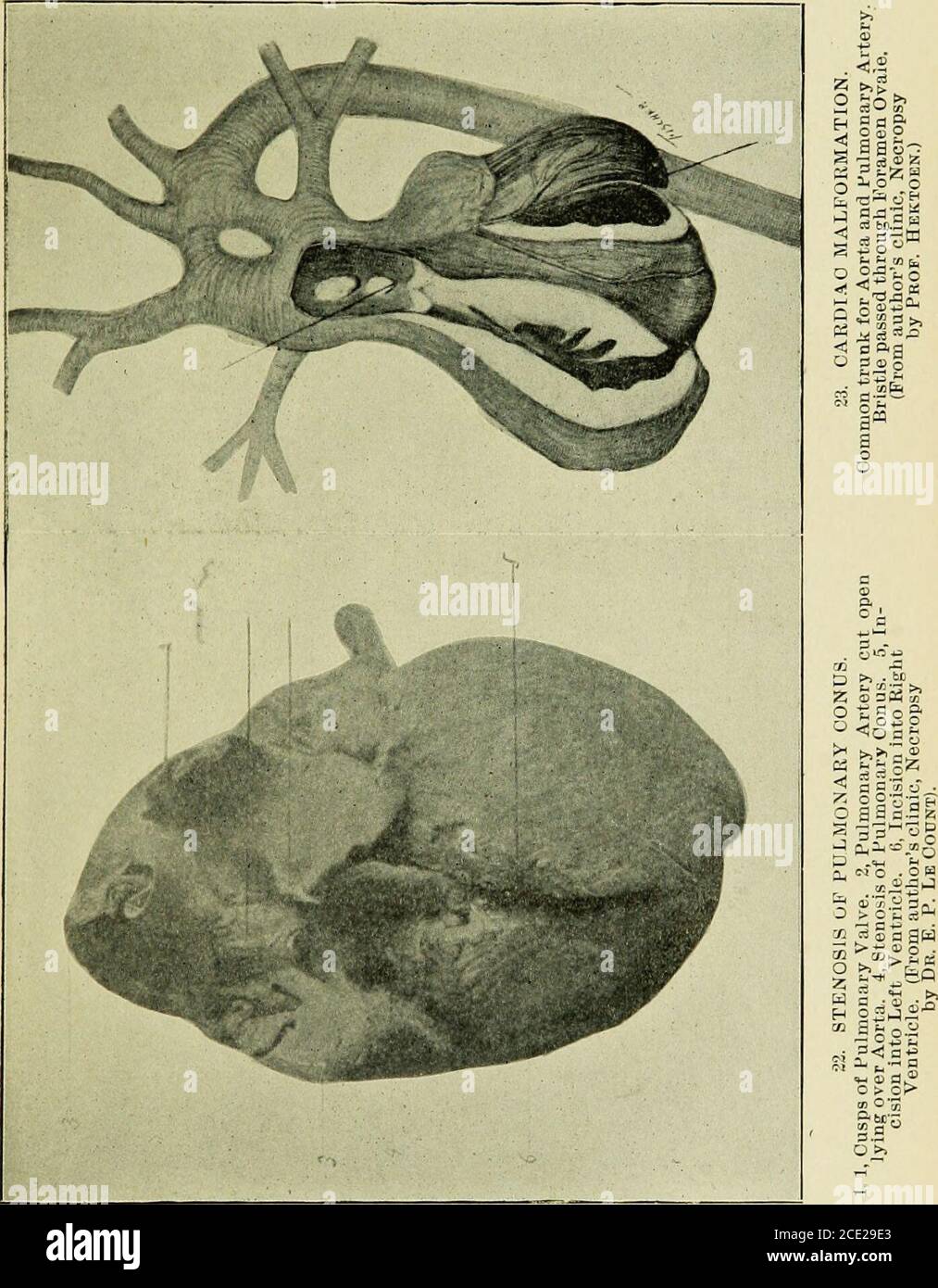 . Lessons on the anatomy, physiology and hygiene of infancy and ...