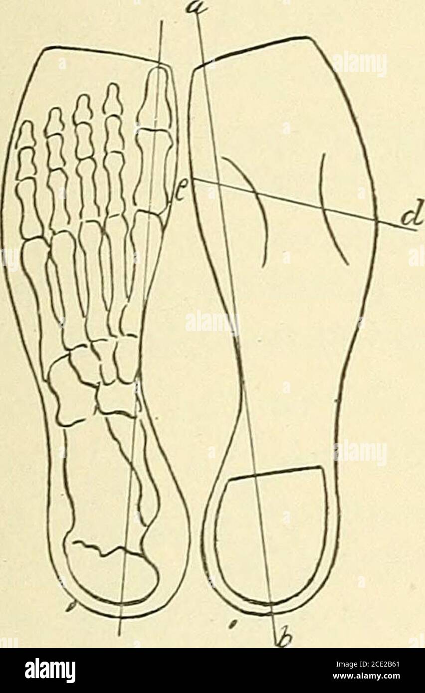 Poor conductor hi-res stock photography and images - Alamy