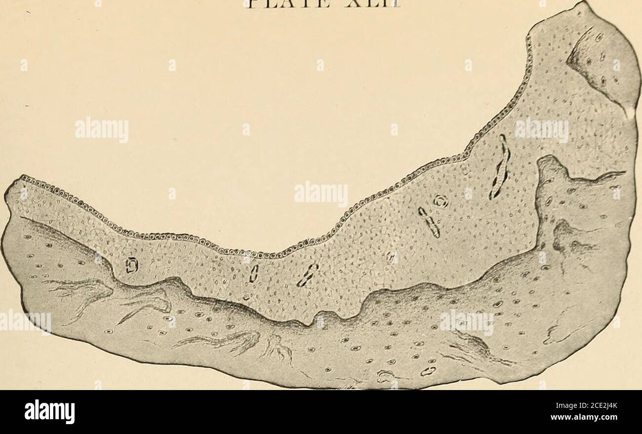 . Diseases of infancy and childhood . scarlet fever, influenza, and ...