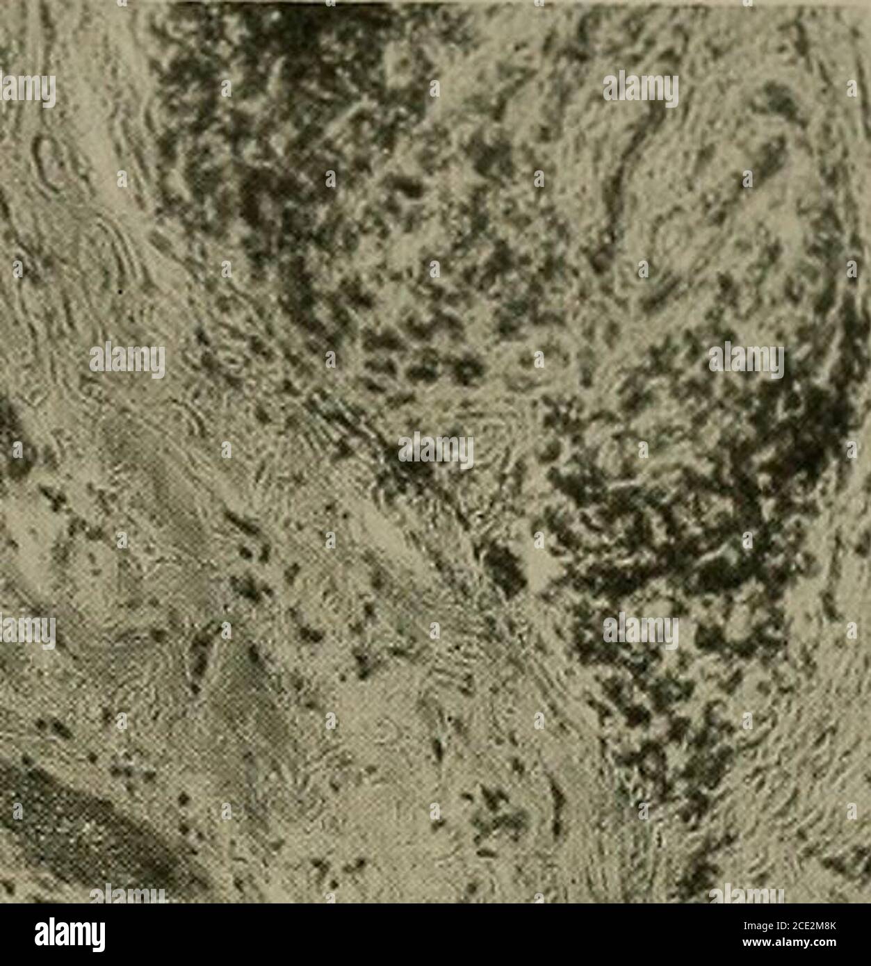 . Syphilis : a treatise on etiology, pathology, diagnosis, prognosis ...