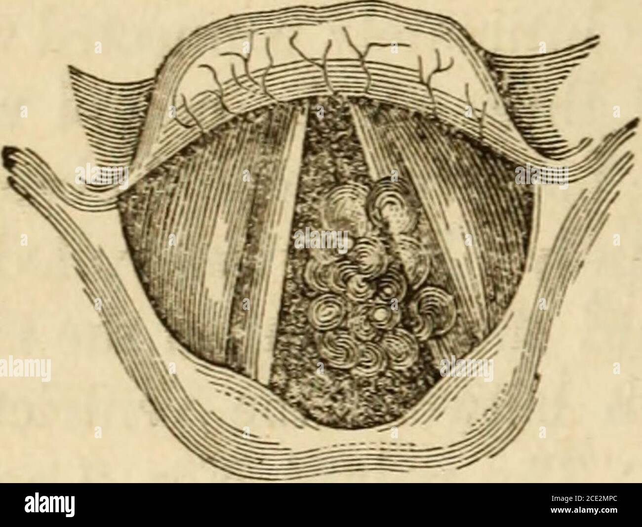 Short polyp hi-res stock photography and images - Alamy