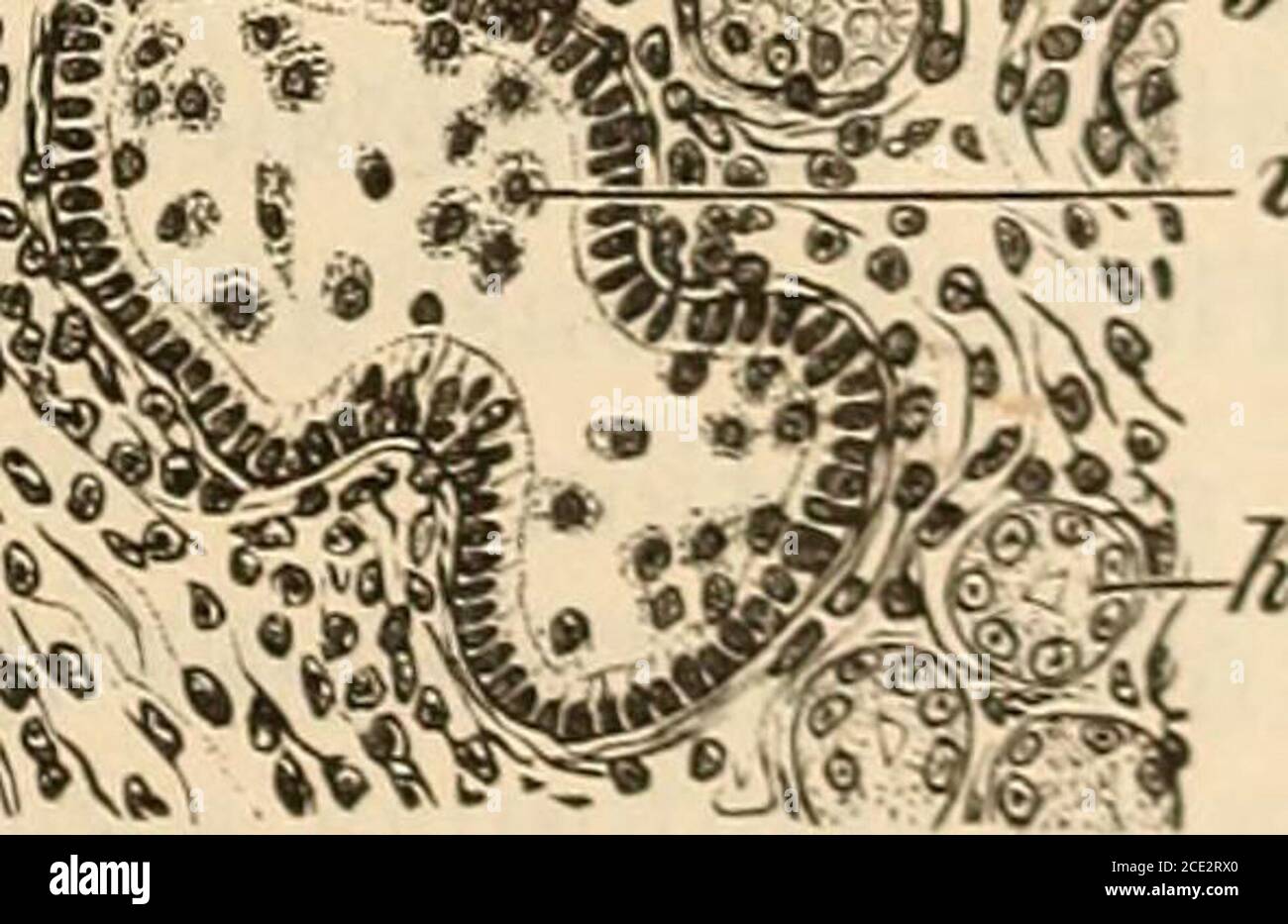 Coagulum fibrin hi-res stock photography and images - Alamy