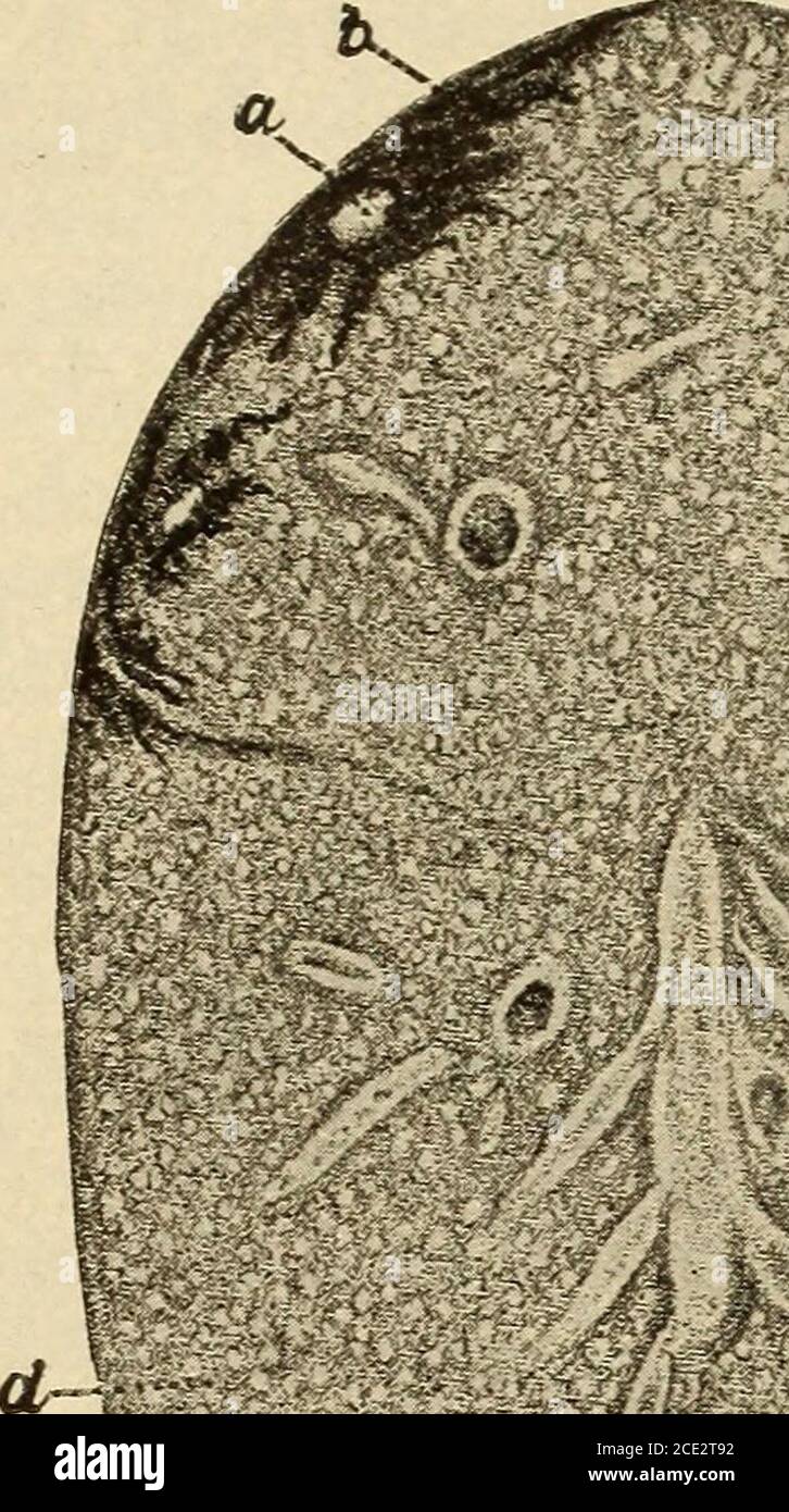 Peribronchial hi-res stock photography and images - Alamy