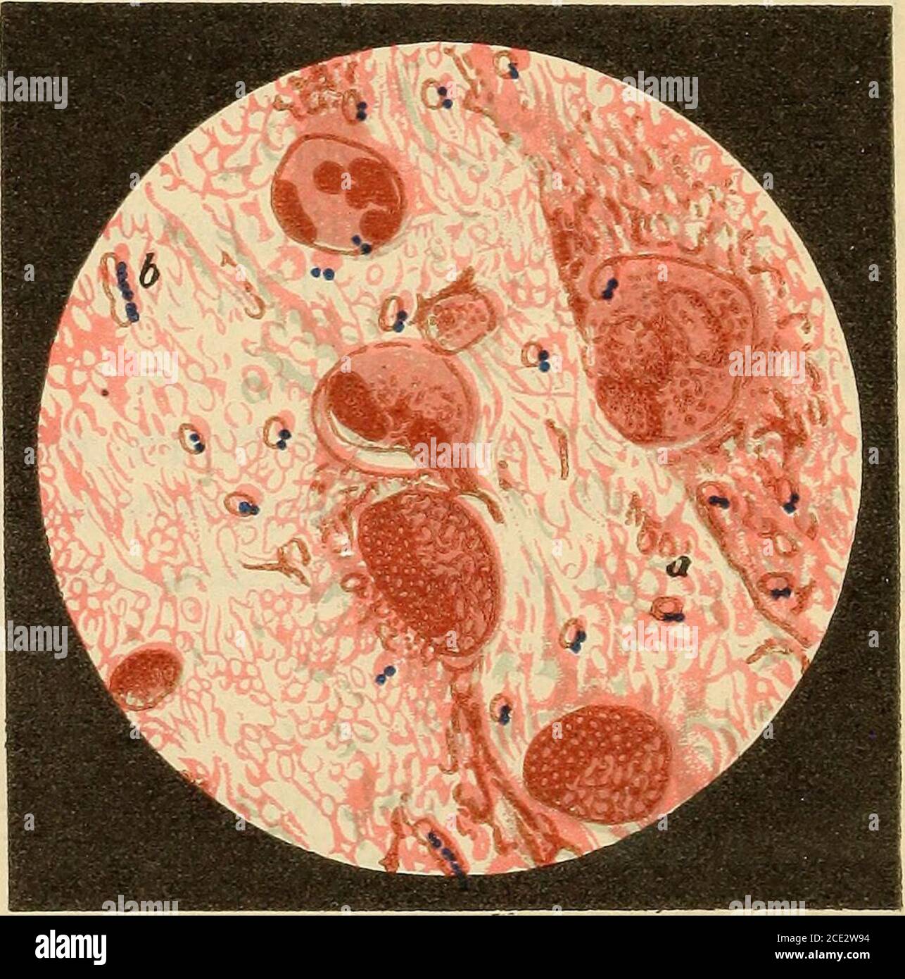 Scrofulous High Resolution Stock Photography and Images - Alamy