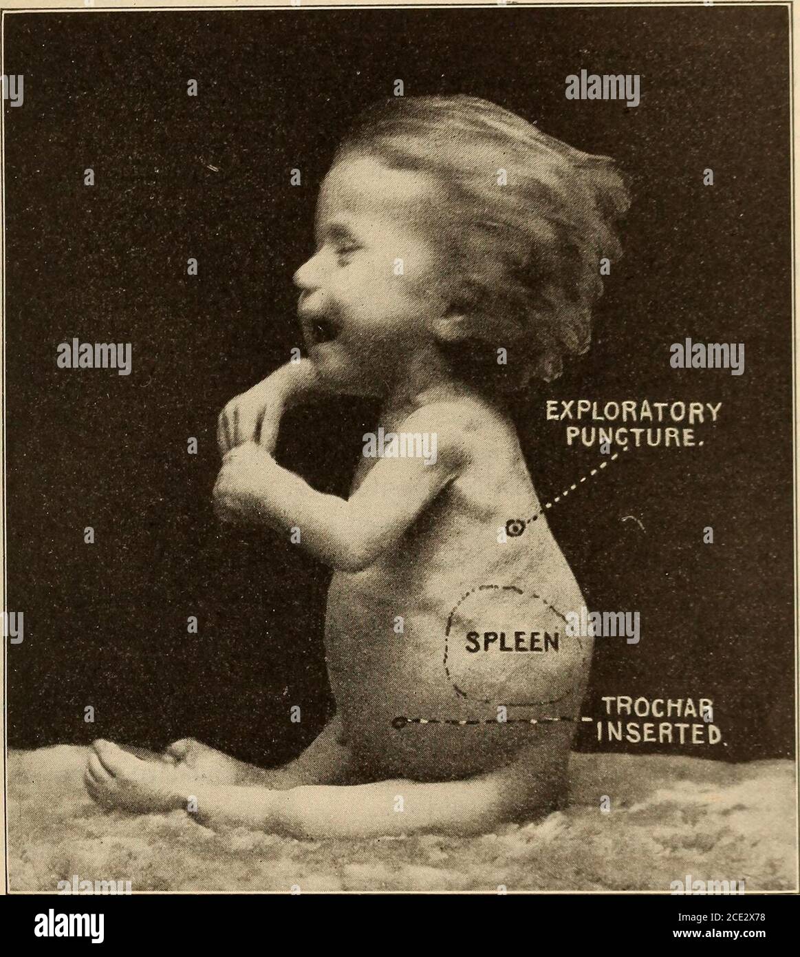 . Diseases of infancy and childhood . ominal wall. In the ...